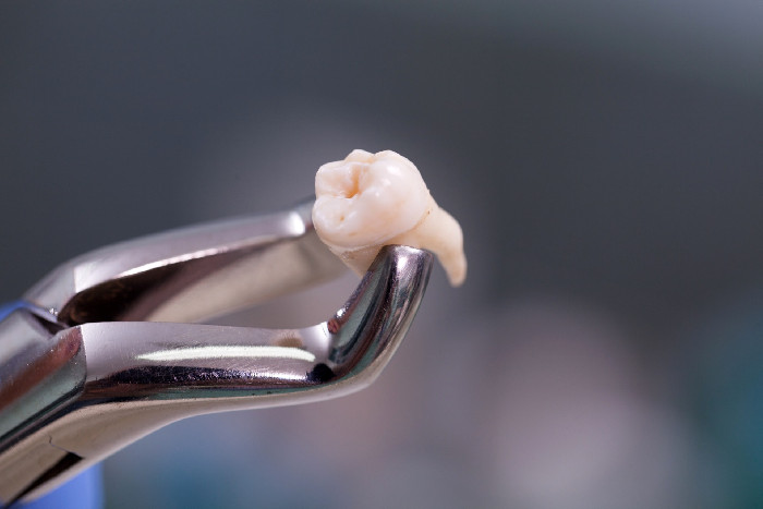 Stomatochirurgie :: ARM Dent